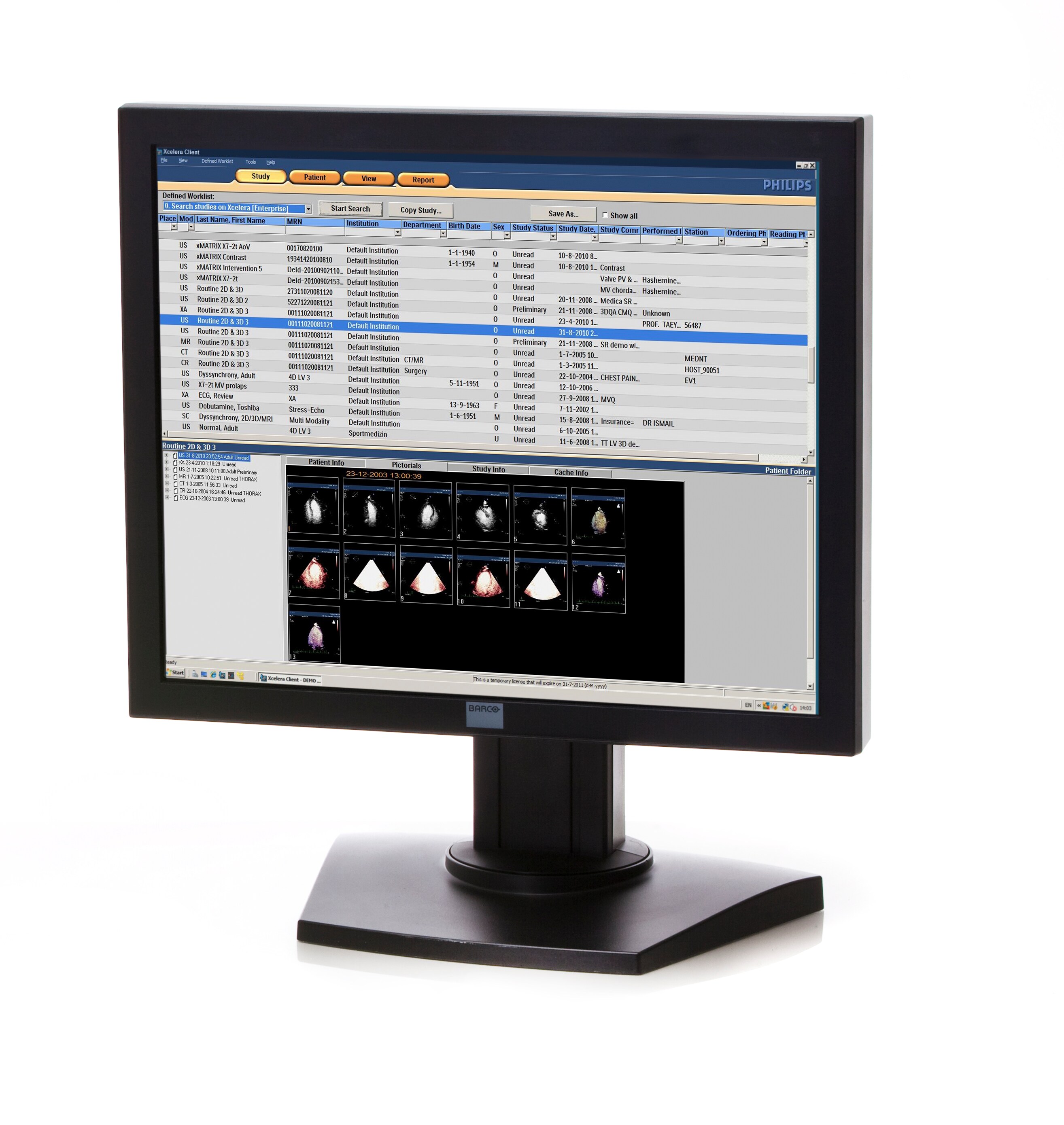 Philips - Xcelera Gestion multimodalité des images de cardiologie