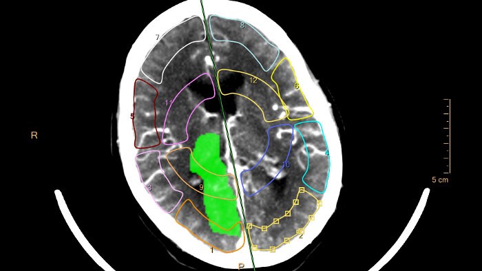 Visualisation avancée et analyse en imagerie radiologique | Philips ...