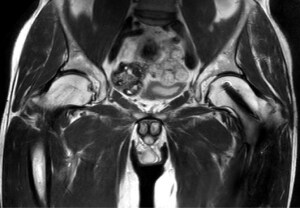 Philips SmartSpeed – Application clinique IRM | Philips