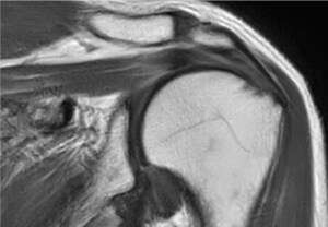 Philips SmartSpeed – Application clinique IRM | Philips